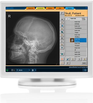 Radiography | Philips Healthcare