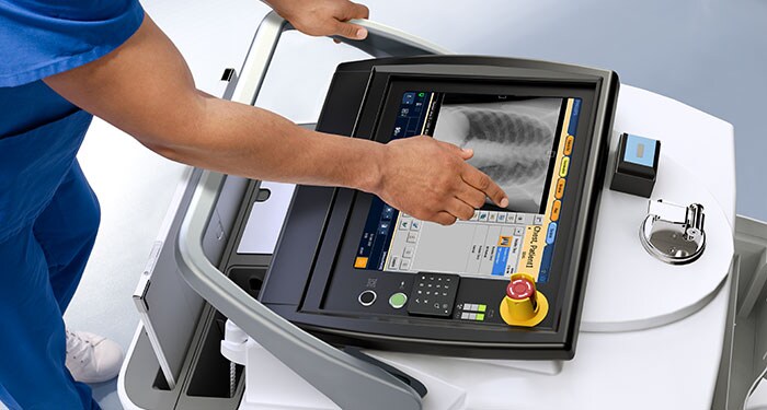 Radiography | Philips Healthcare