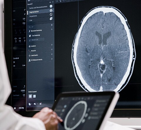 Image-guided therapy | Philips