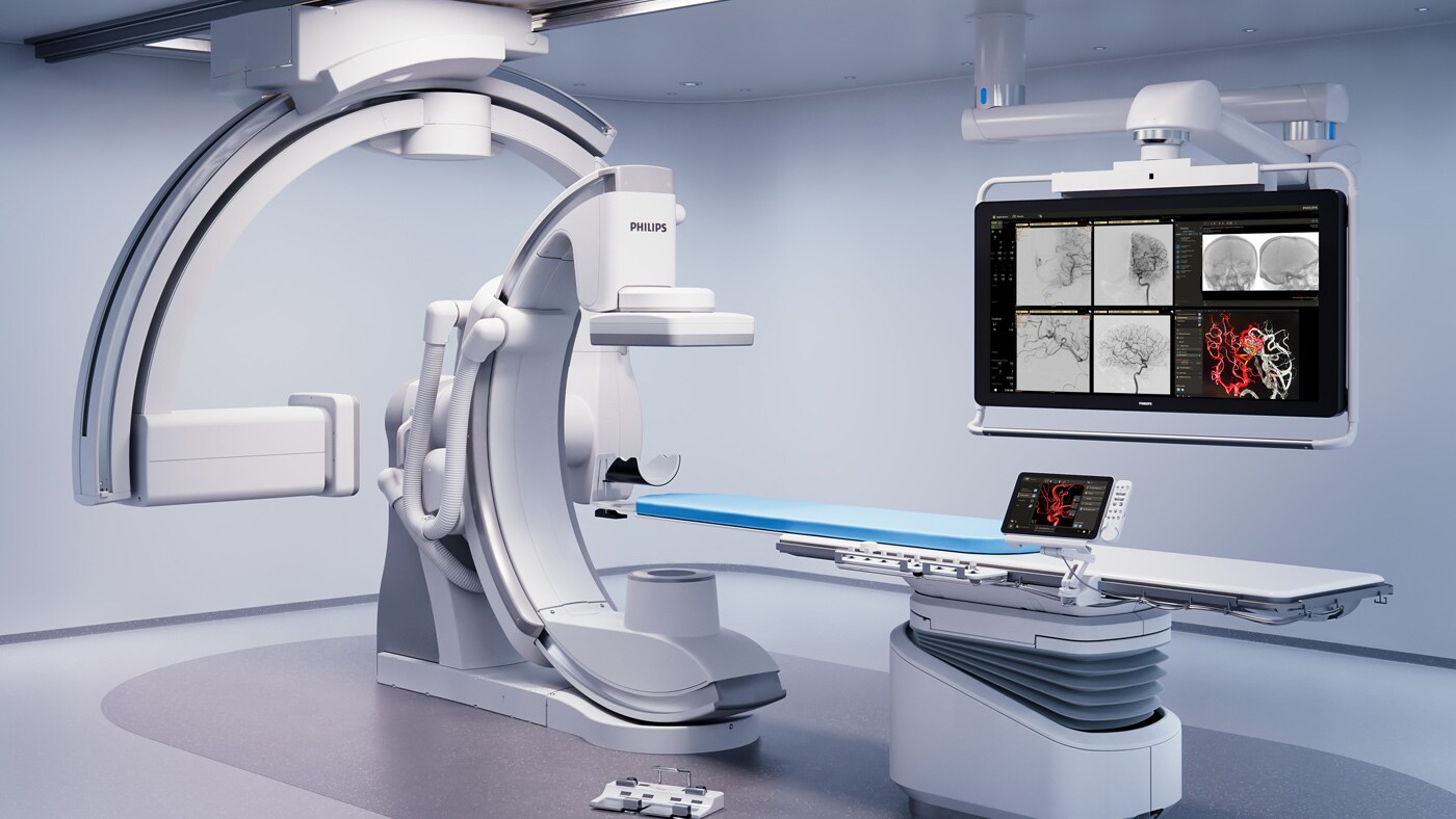 AVM treatment | Philips