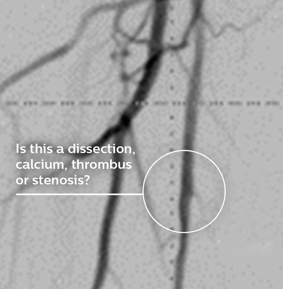 See clearly. Treat optimally. | Philips