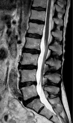 Philips SmartSpeed – MR Clinical Application | Philips Healthcare