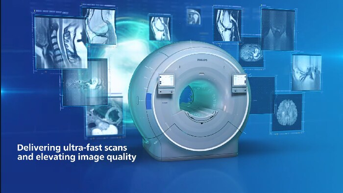 Philips SmartSpeed – MR Clinical Application | Philips