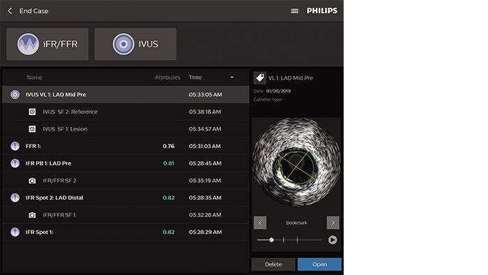 IntraSight Interventional Applications Platform | Philips