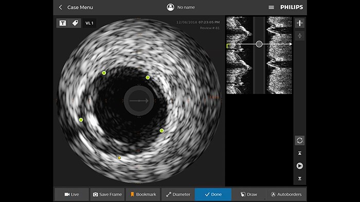 IntraSight Interventional Applications Platform | Philips