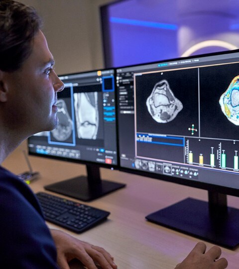 Smart Workflow solutions in MR | Philips