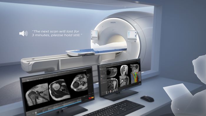 Smart Workflow solutions in MR | Philips