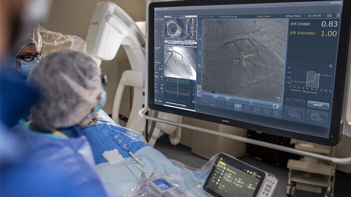 iFR modality | Philips